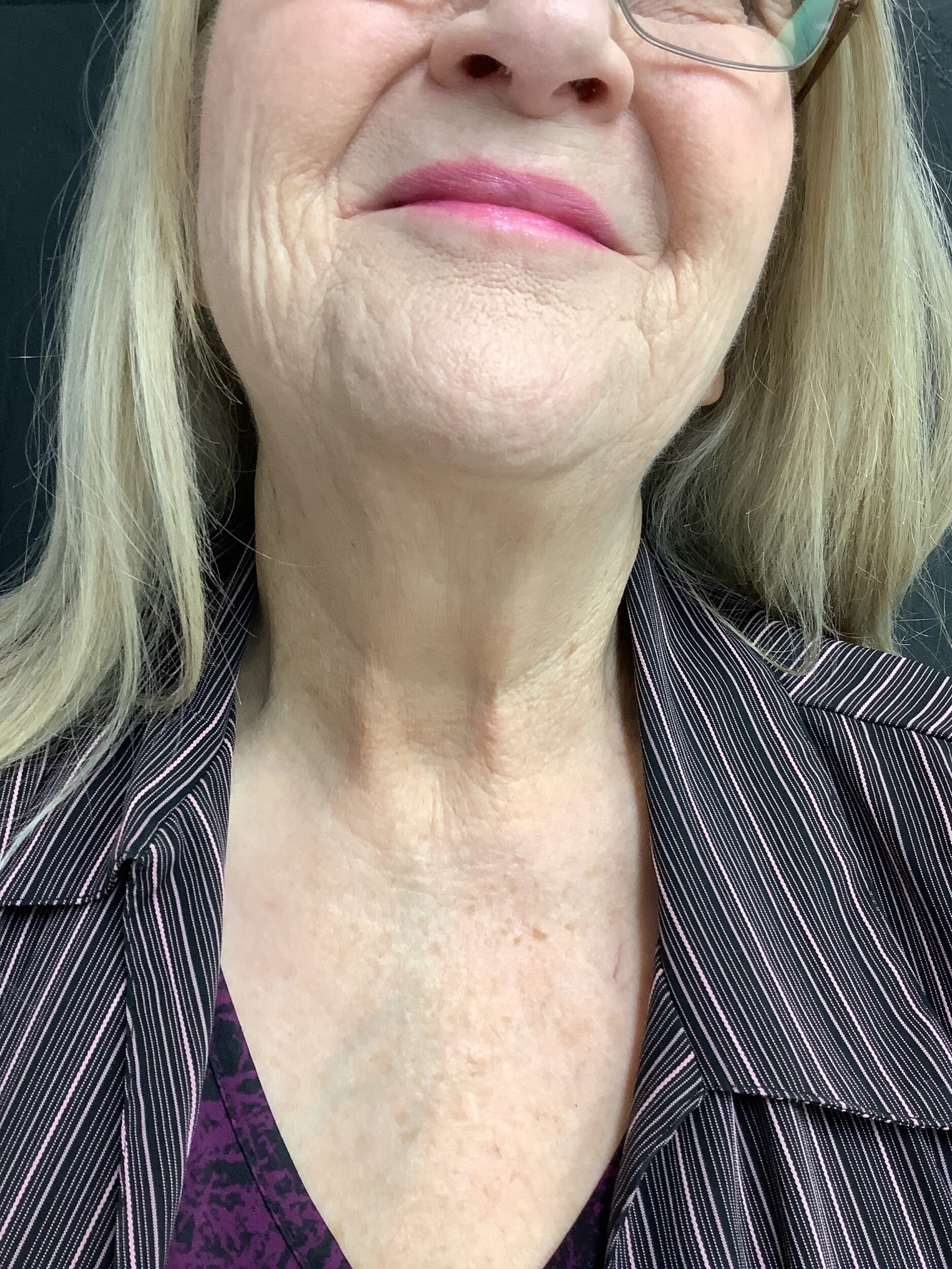 ResurFX Archives - MedAesthetics